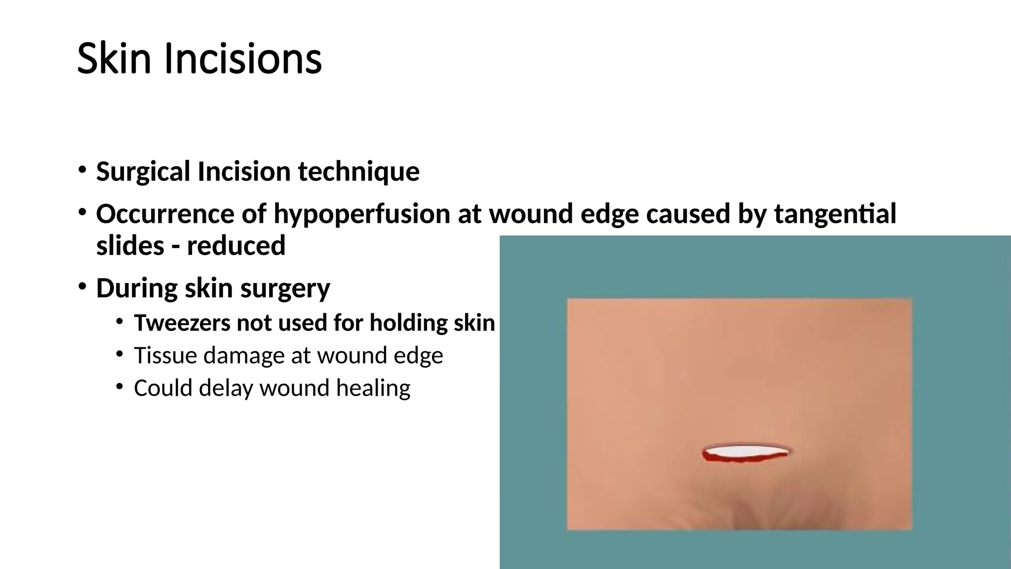 PRINCIPLES OF SKIN INCISION PRINCIPLES OF SKIN INCISION | PPTX