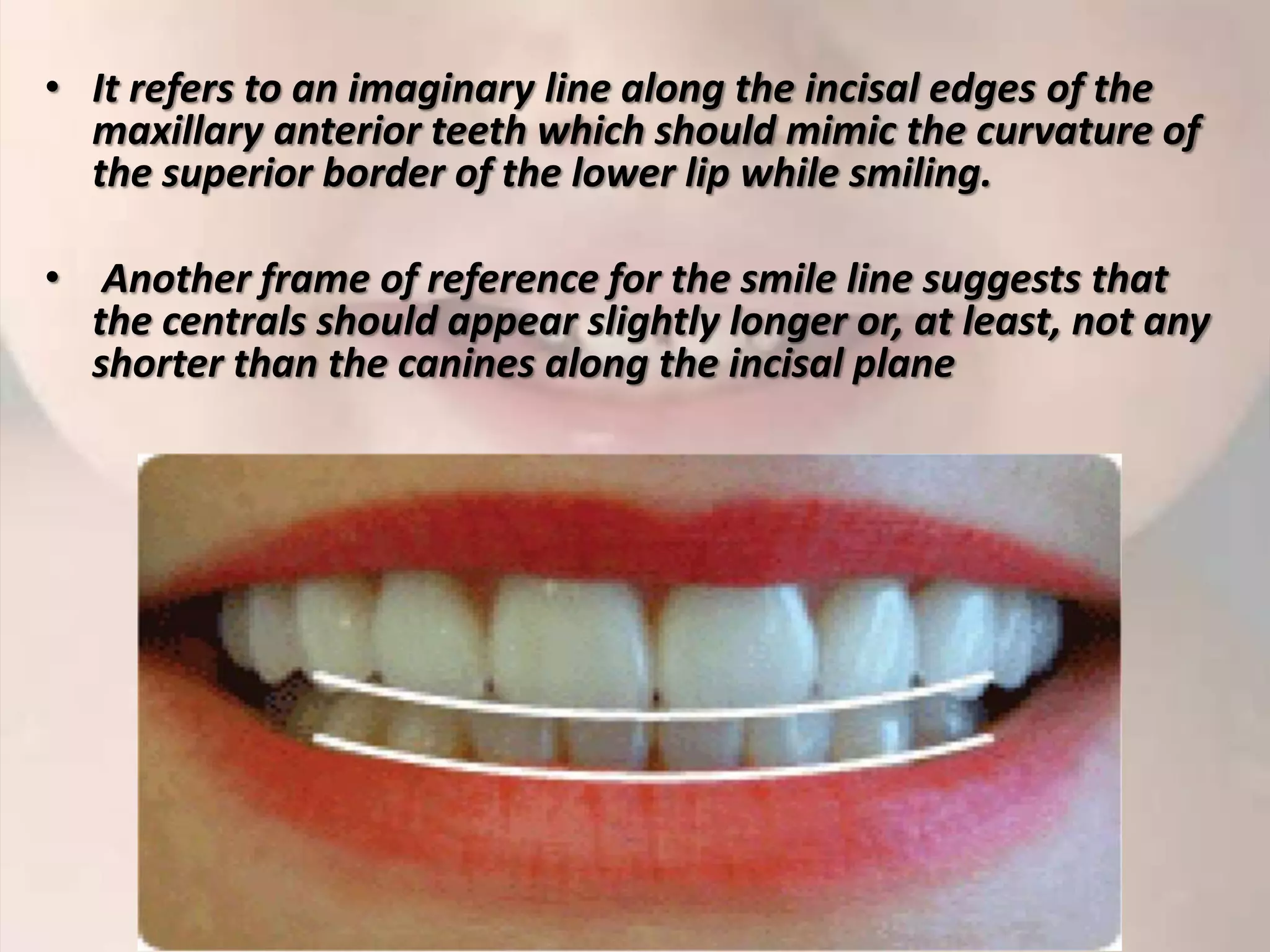 Principles of smile design | PPTX