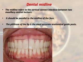 Principles of smile design | PPTX