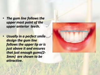 Principles of smile design | PPTX