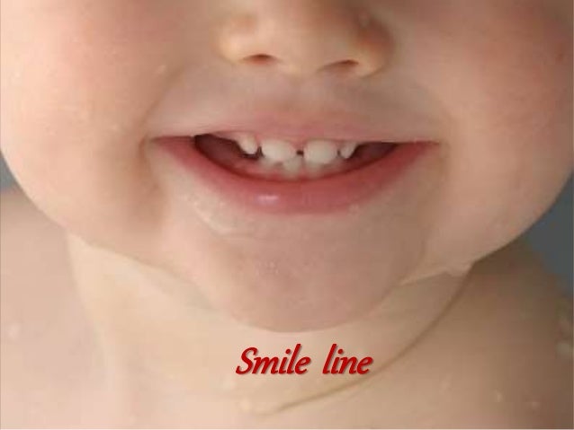 Principles of smile design