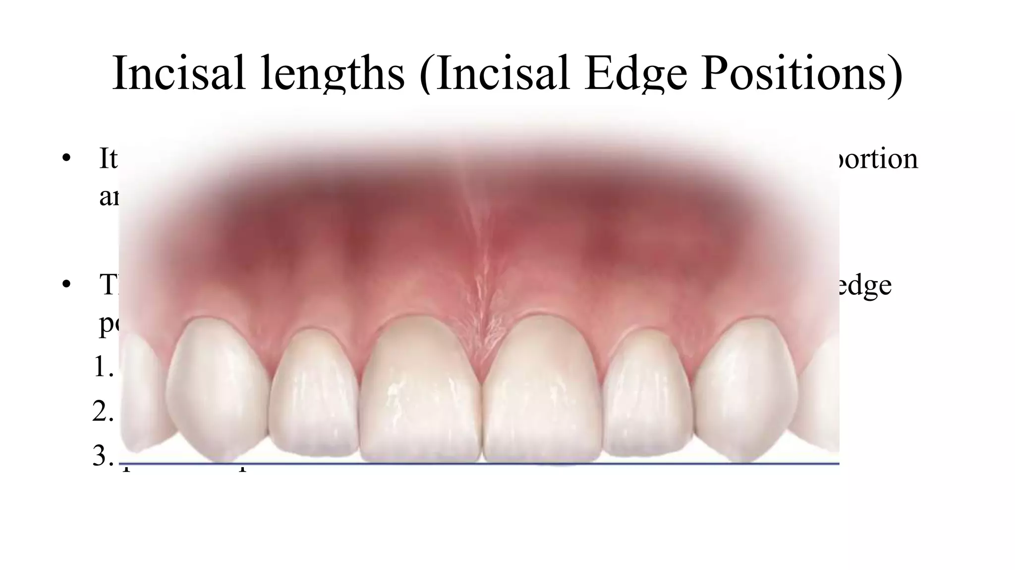 Principles of smile design | PPTX