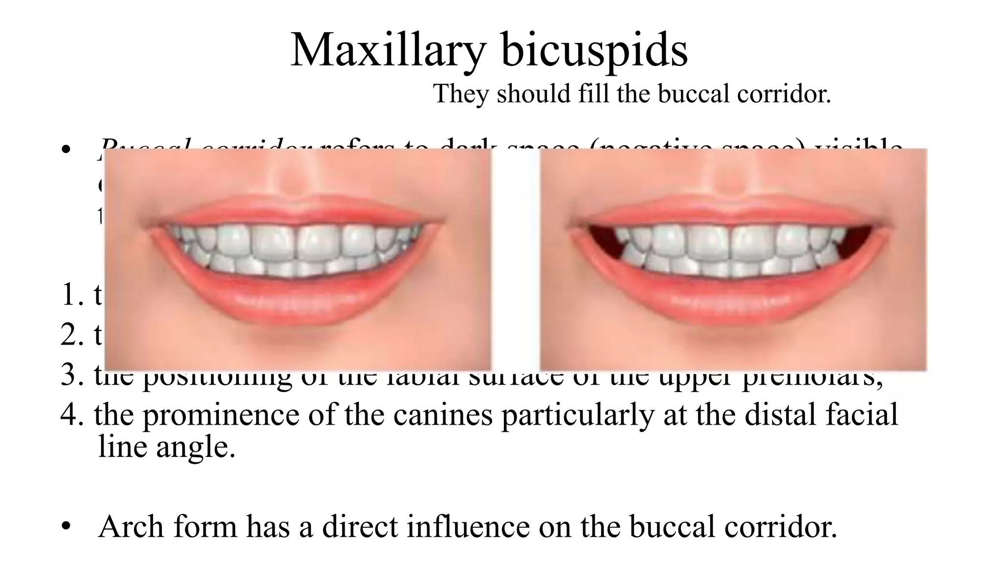 Principles of smile design | PPTX