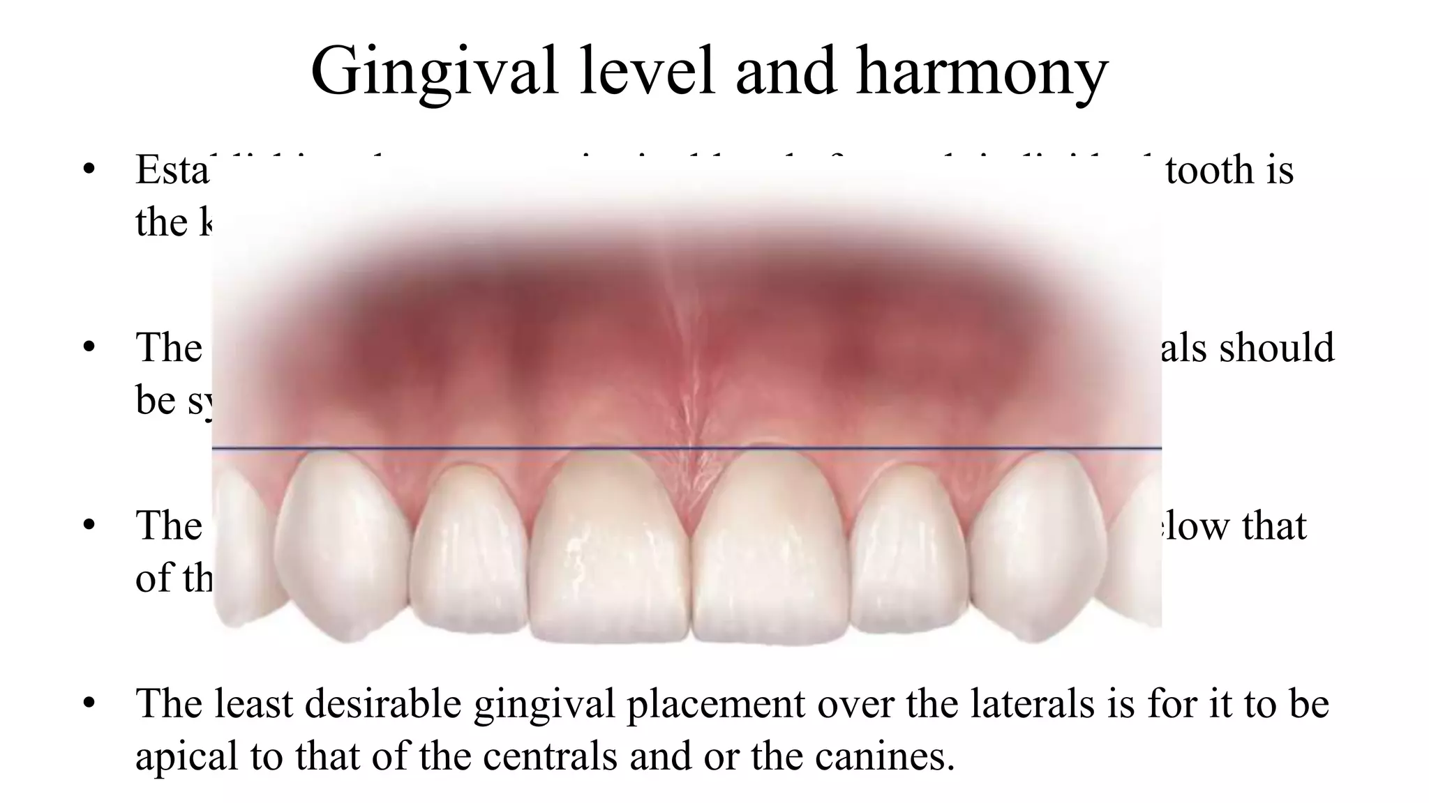 Principles of smile design | PPTX