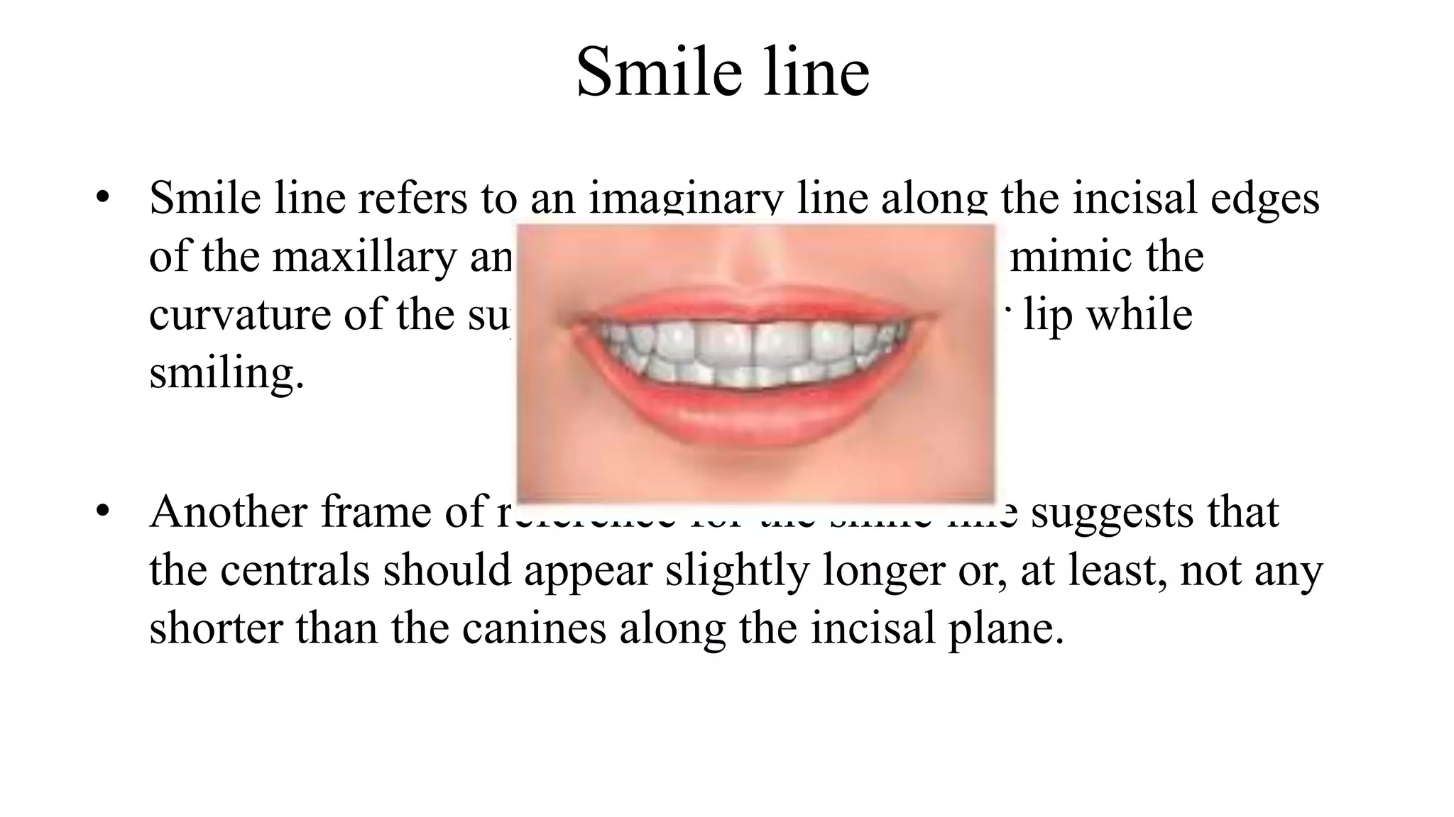 Principles of smile design | PPTX