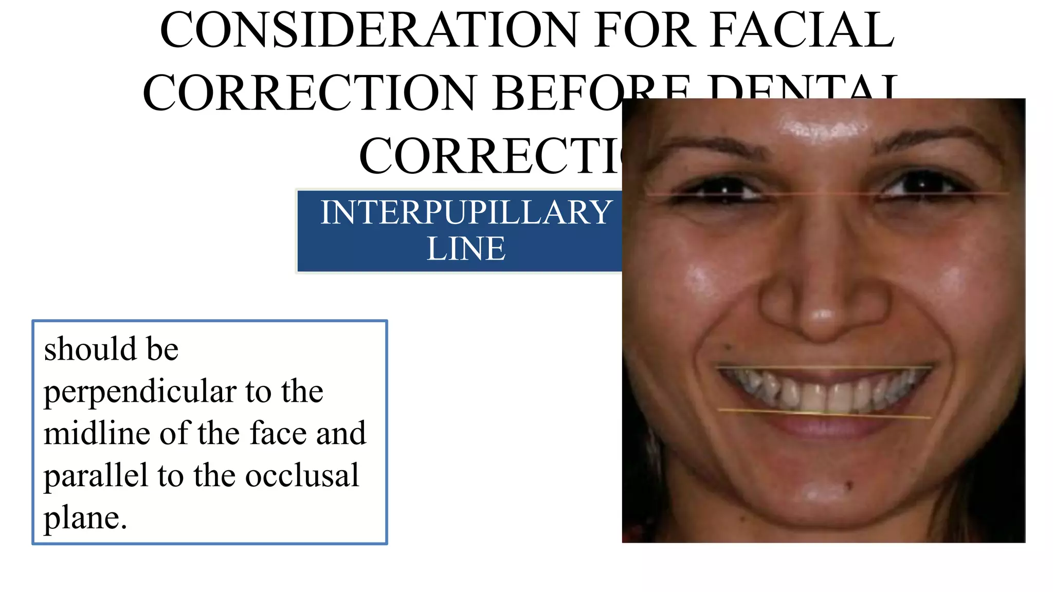 Principles of smile design | PPTX