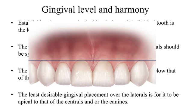 Principles of smile design | PPTX | Dental Health | Diseases and Conditions