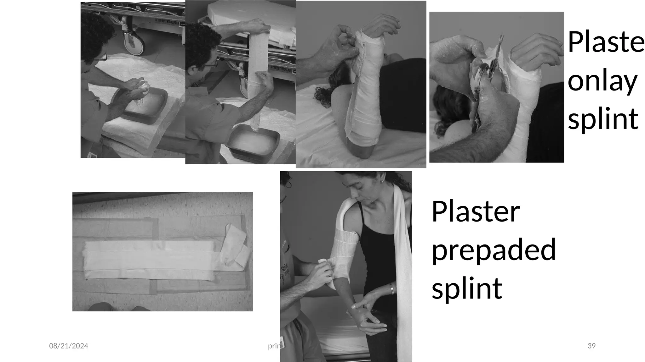 Principles of splints and casts (2).pptx