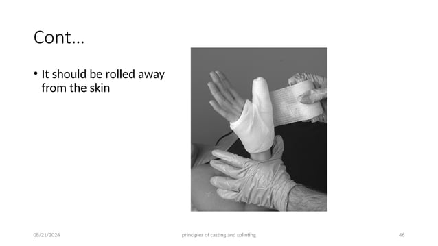 Principles of splints and casts (2).pptx