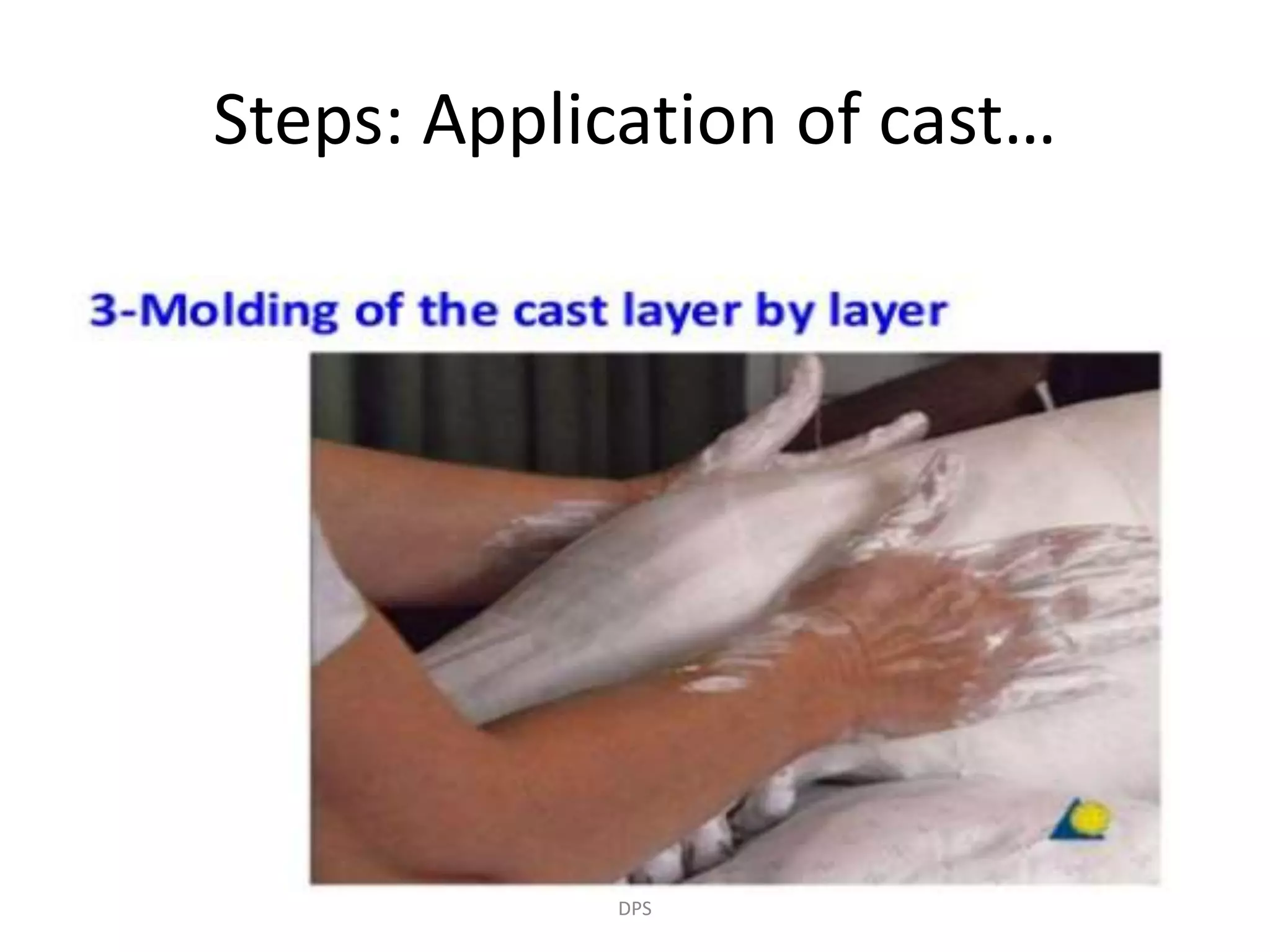 Principles of splints and casts in orthopaedics by Dr. D. P. Swami | PPTX