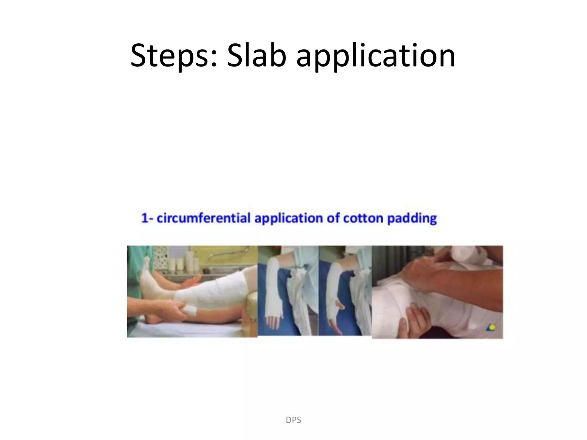 Principles of splints and casts in orthopaedics by Dr. D. P. Swami | PPTX
