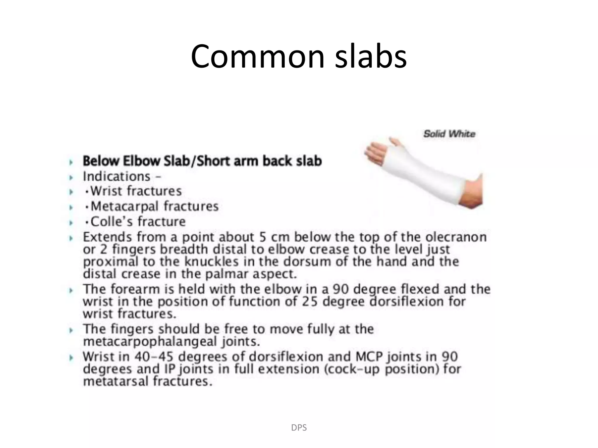 Principles of splints and casts in orthopaedics by Dr. D. P. Swami | PPTX