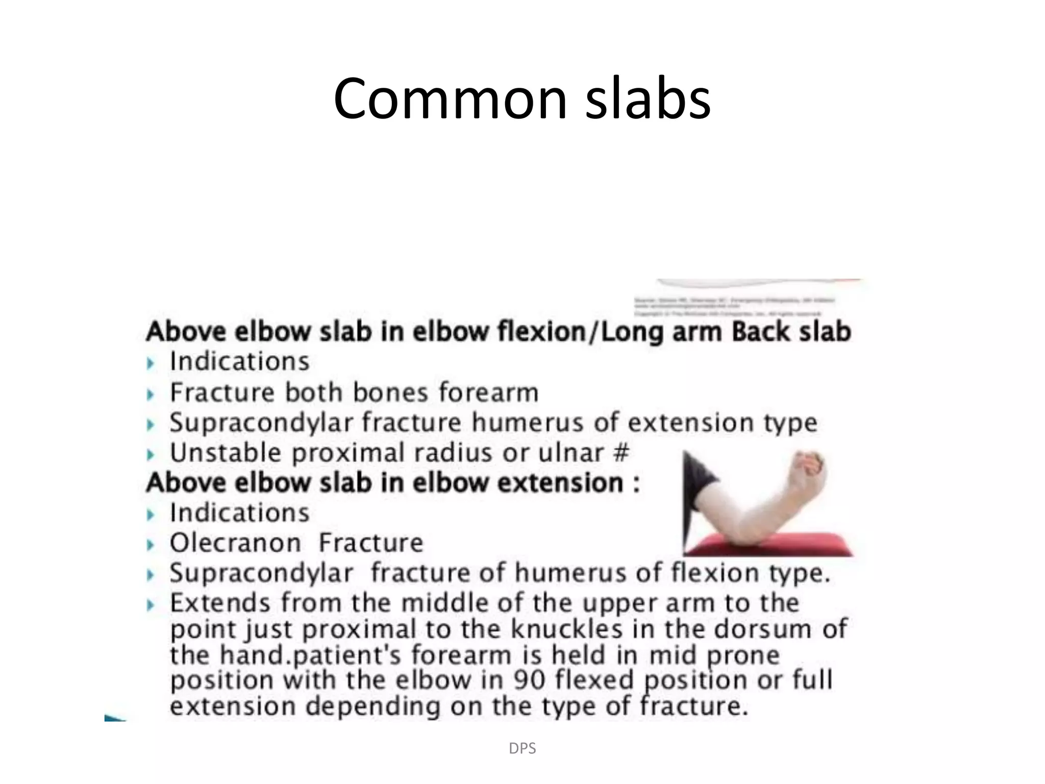 Principles of splints and casts in orthopaedics by Dr. D. P. Swami | PPTX