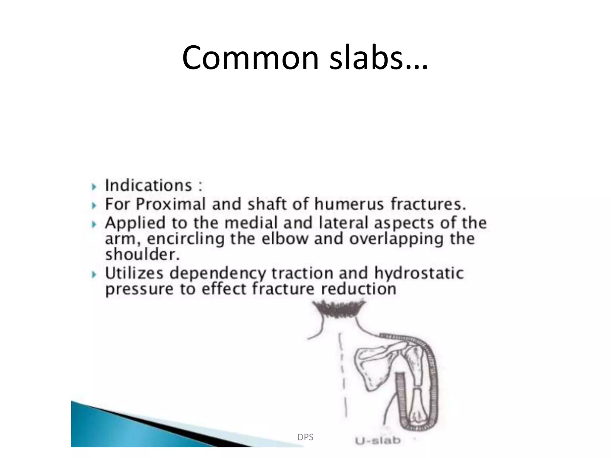 Principles of splints and casts in orthopaedics by Dr. D. P. Swami | PPTX