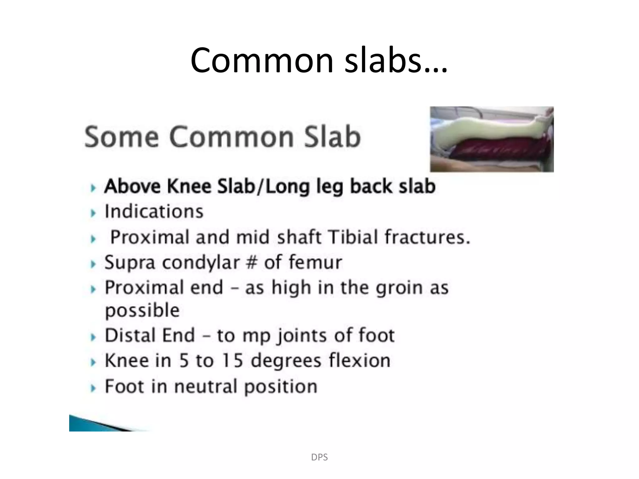 Principles of splints and casts in orthopaedics by Dr. D. P. Swami | PPTX