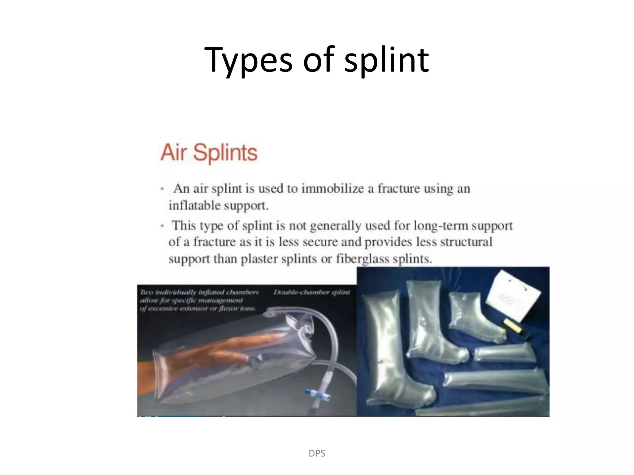 Principles of splints and casts in orthopaedics by Dr. D. P. Swami | PPTX