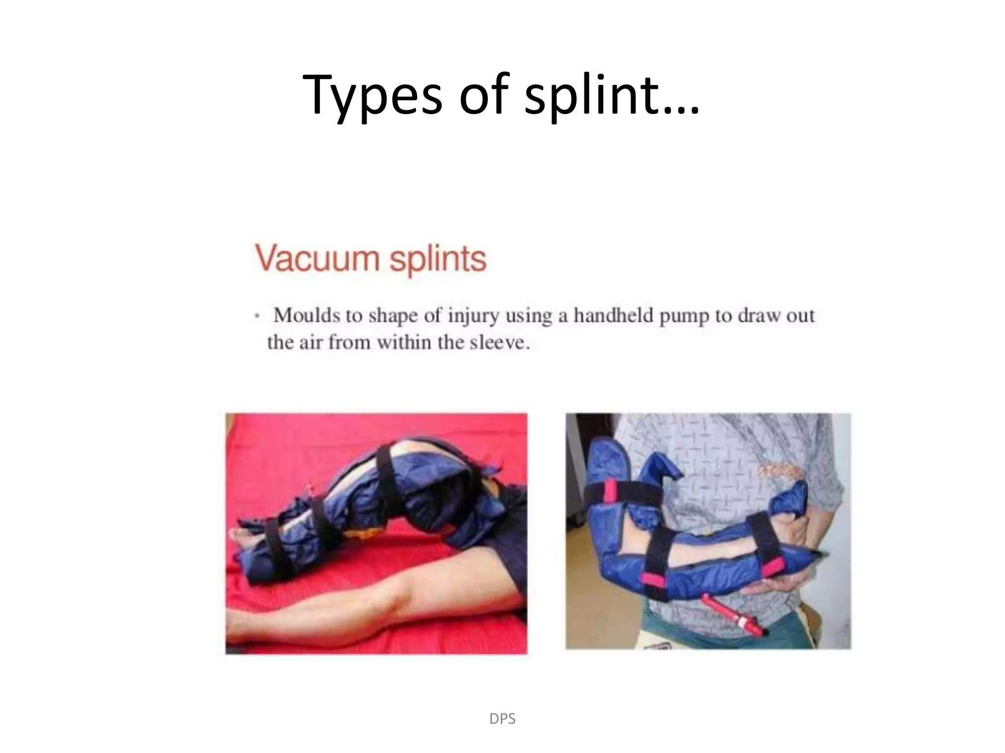 Principles of splints and casts in orthopaedics by Dr. D. P. Swami | PPTX