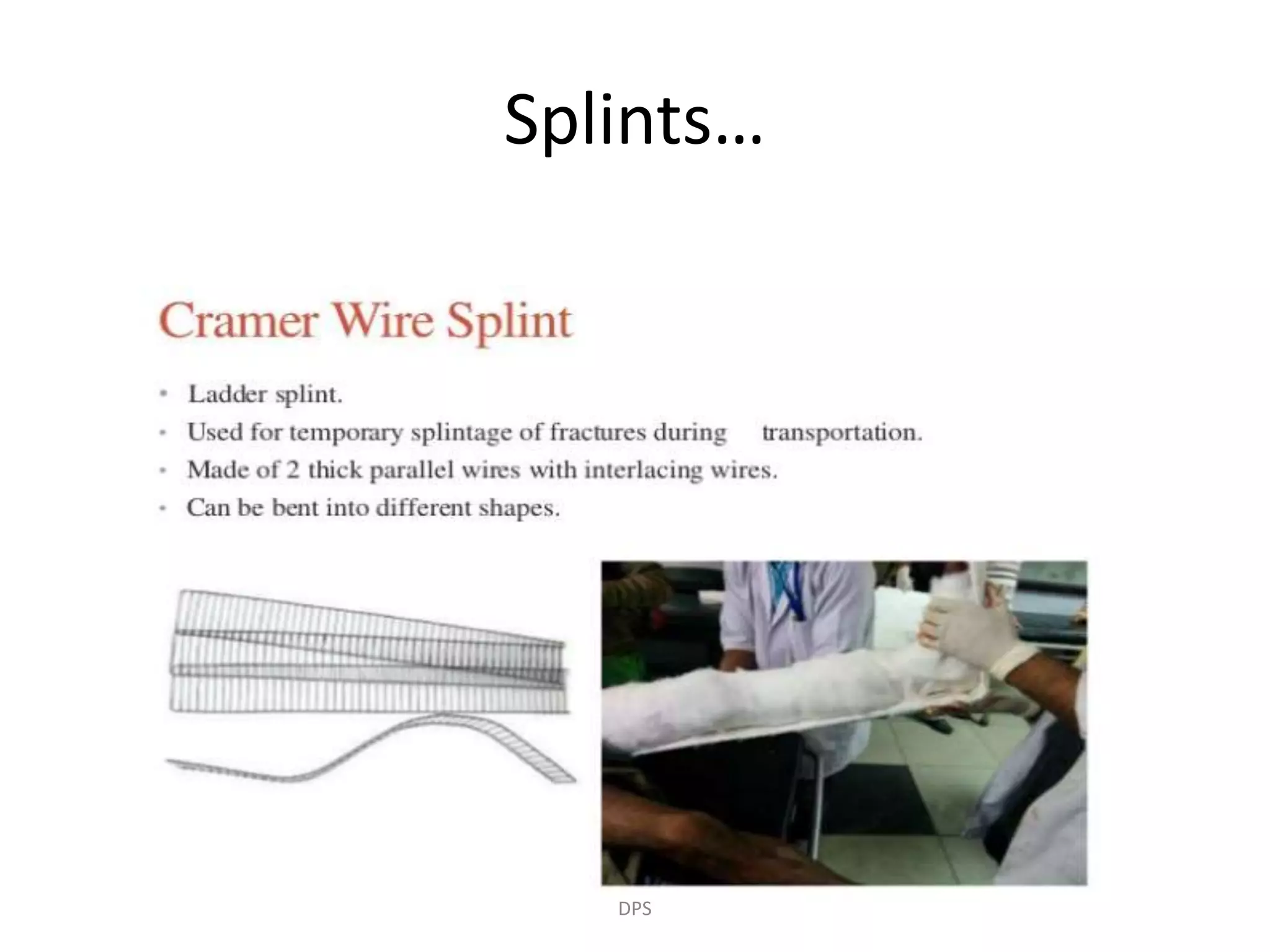 Principles of splints and casts in orthopaedics by Dr. D. P. Swami | PPTX