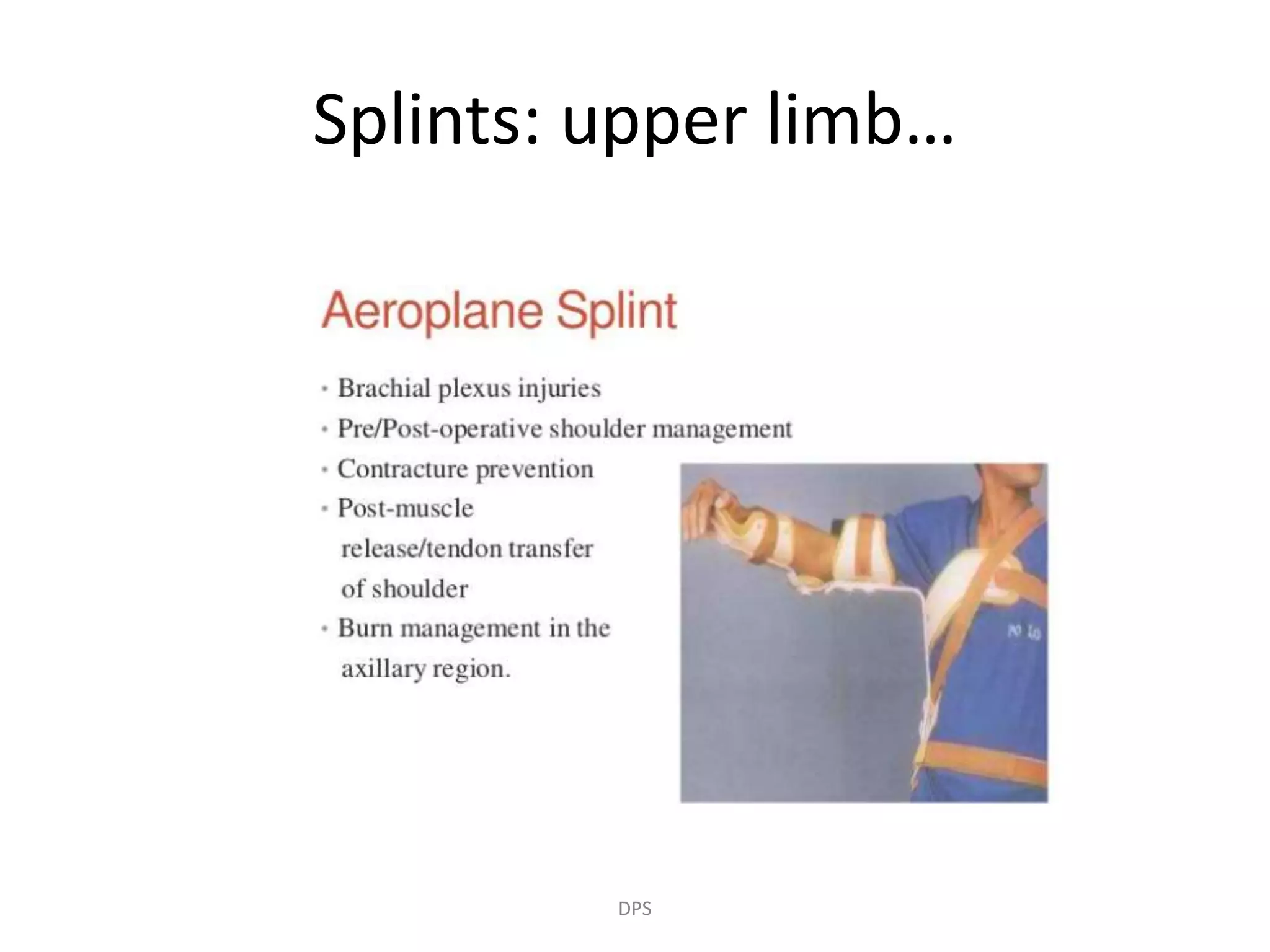 Principles of splints and casts in orthopaedics by Dr. D. P. Swami | PPTX