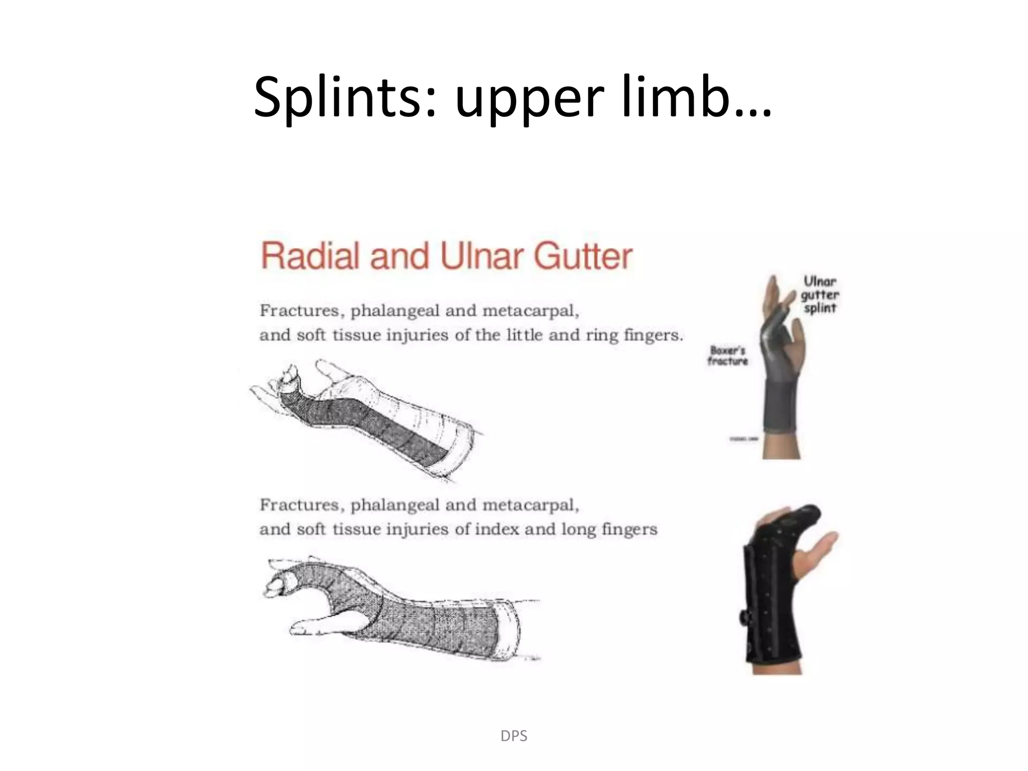 Principles of splints and casts in orthopaedics by Dr. D. P. Swami | PPTX