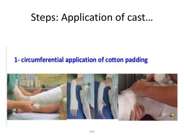 Principles of splints and casts in orthopaedics by Dr. D. P. Swami | PPTX