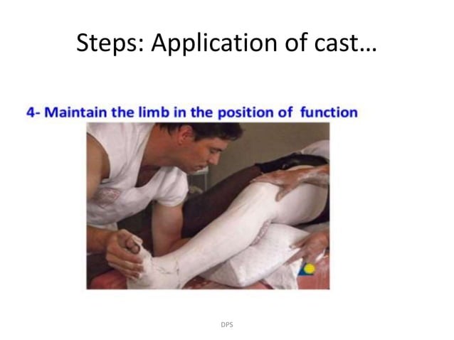 Principles of splints and casts in orthopaedics by Dr. D. P. Swami | PPT