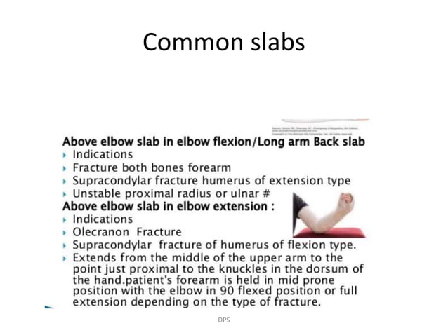 Principles of splints and casts in orthopaedics by Dr. D. P. Swami | PPTX