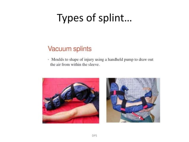 Principles of splints and casts in orthopaedics by Dr. D. P. Swami | PPT