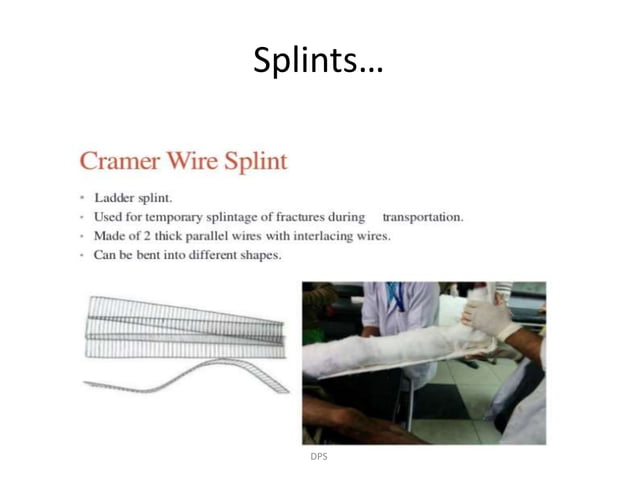 Principles of splints and casts in orthopaedics by Dr. D. P. Swami | PPTX