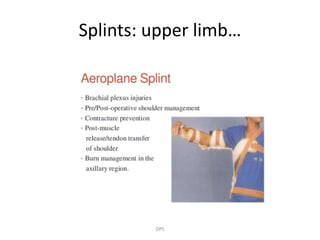 Principles of splints and casts in orthopaedics by Dr. D. P. Swami | PPTX