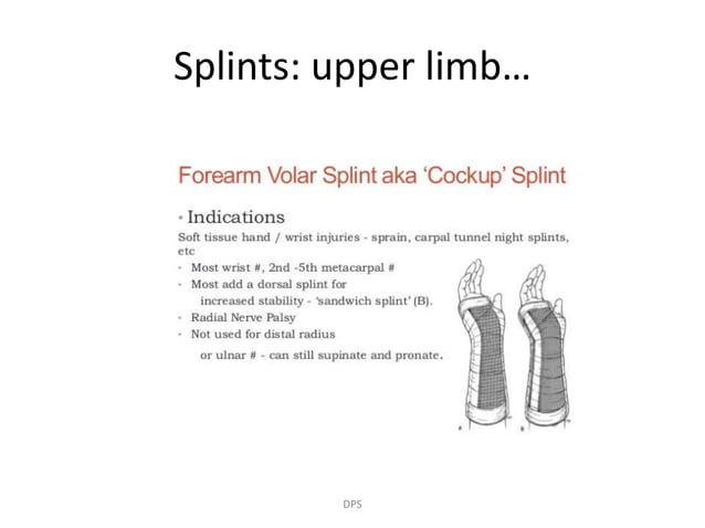 Principles of splints and casts in orthopaedics by Dr. D. P. Swami | PPTX