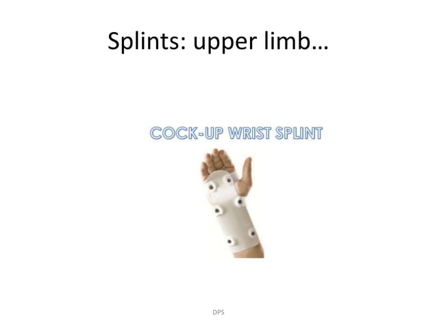 Principles of splints and casts in orthopaedics by Dr. D. P. Swami | PPTX