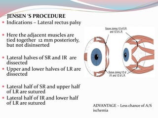 Principles of strabismus surgery | PPTX