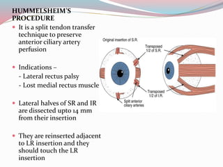 Principles of strabismus surgery | PPTX