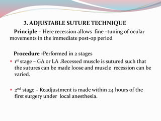 Principles of strabismus surgery | PPTX