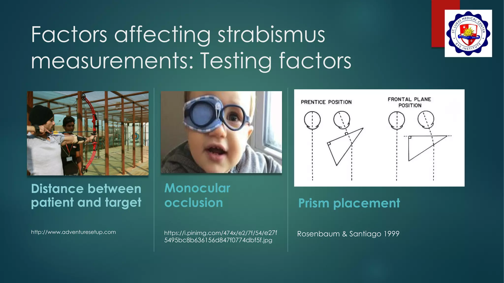 Principles of strabismus surgery part 1 of 3 | PDF