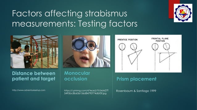 Principles of strabismus surgery part 1 of 3 | PDF | Eye and Vision ...