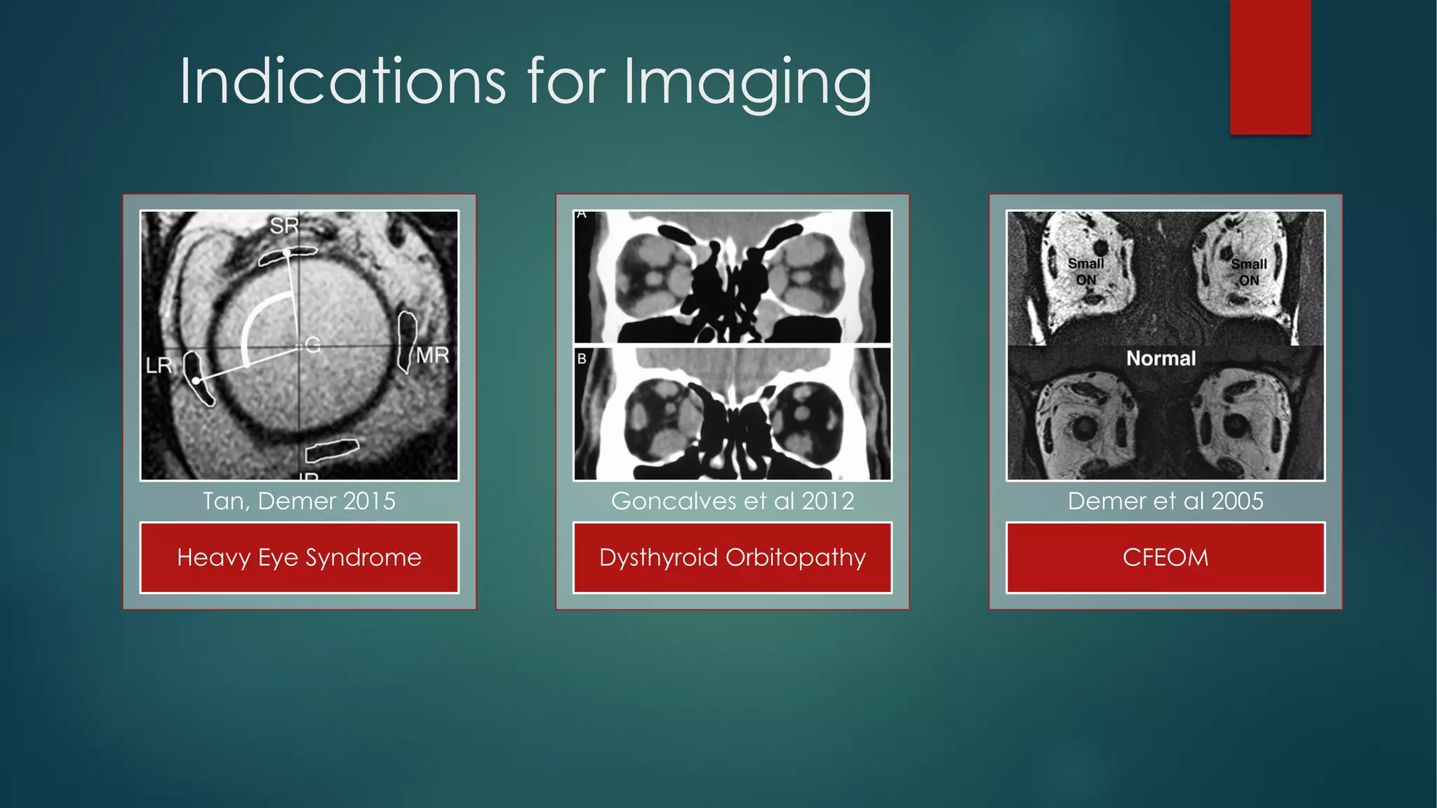 Principles of strabismus surgery part 2 of 3 | PDF