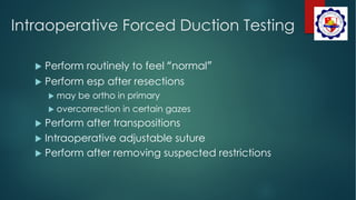 Principles of strabismus surgery part 2 of 3 | PDF