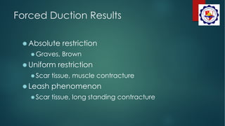 Principles of strabismus surgery part 2 of 3 | PDF