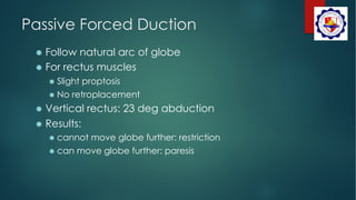 Principles of strabismus surgery part 2 of 3 | PDF