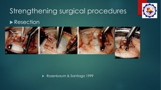 Principles of strabismus surgery part 3 of 3 | PDF