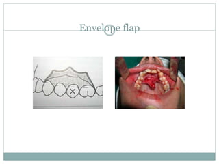 ORAL AND MAXILLOFACIAL principles of surgery.pptx | First Aid | Injuries