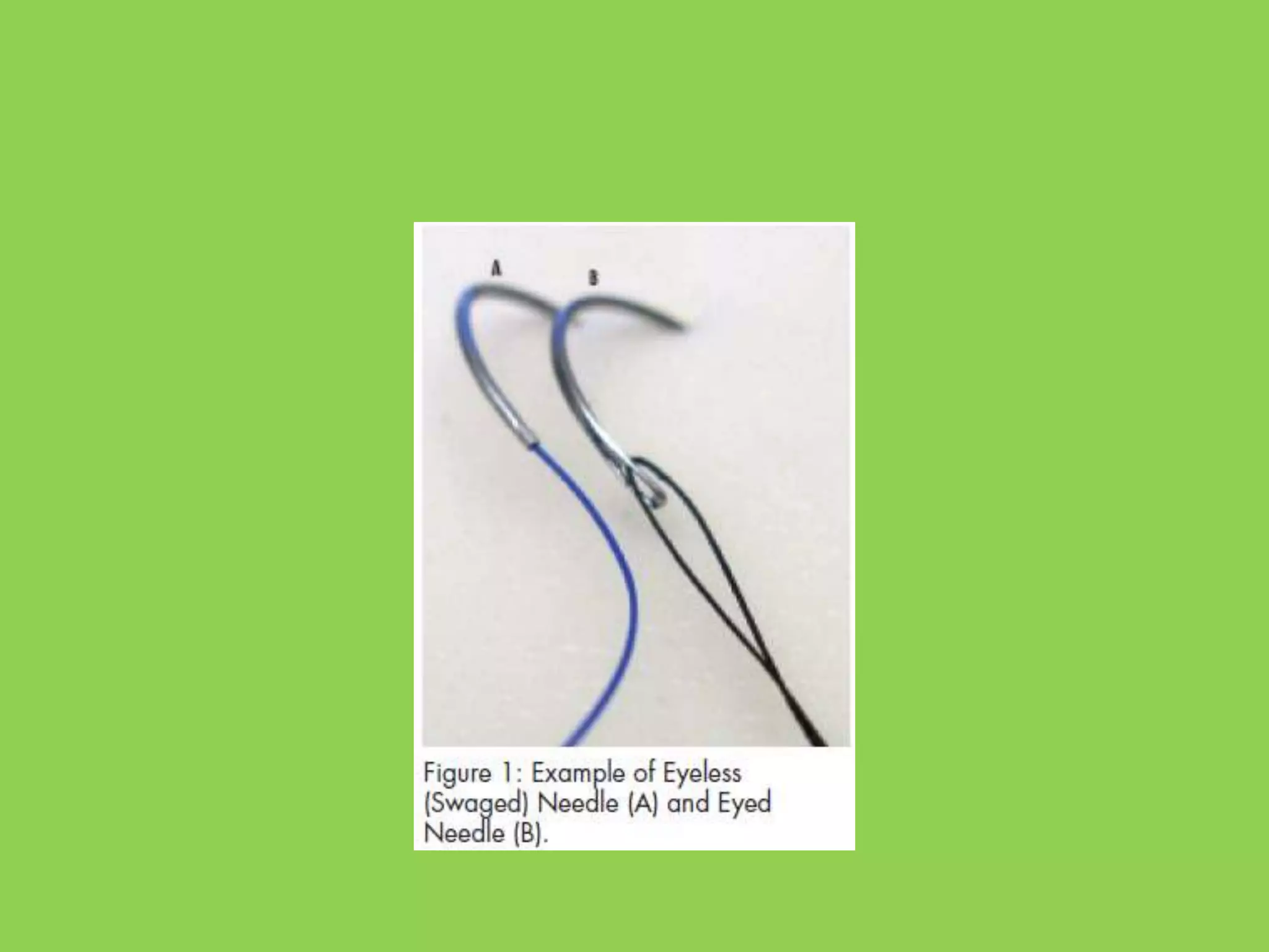 Principles of suture and flap design | PPTX