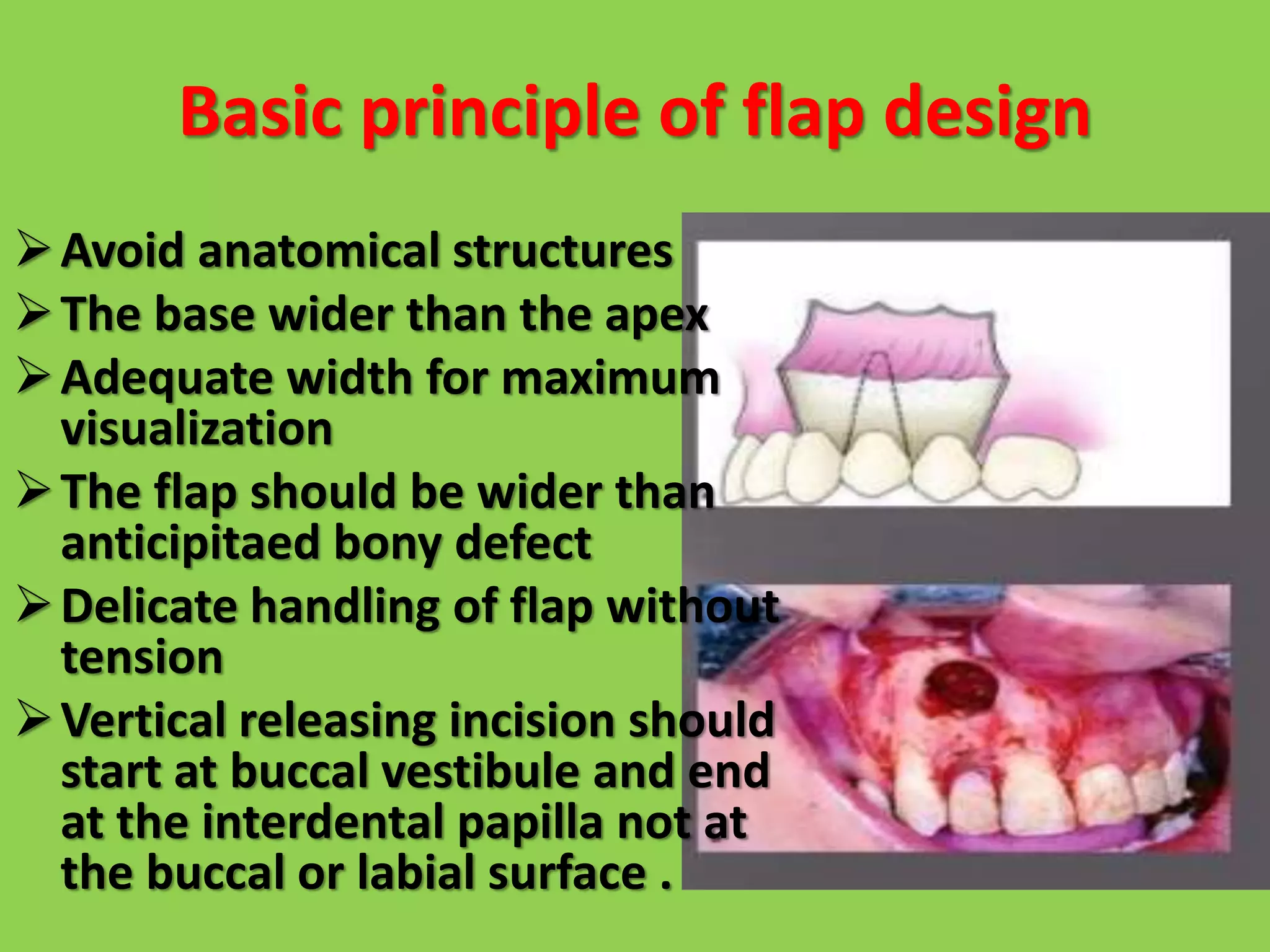 Principles of suture and flap design | PPTX