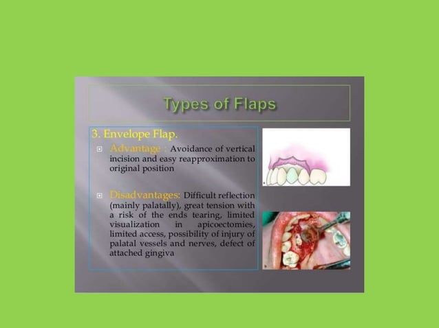 Principles of suture and flap design | PPTX