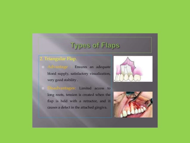 Principles of suture and flap design | PPTX