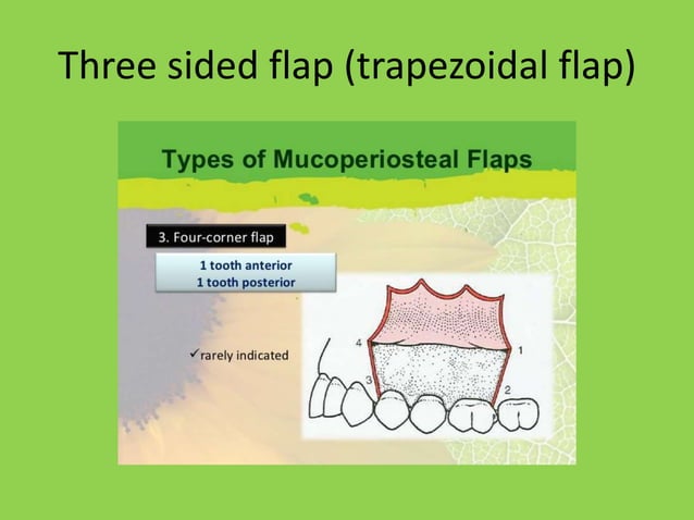 Principles of suture and flap design | PPTX