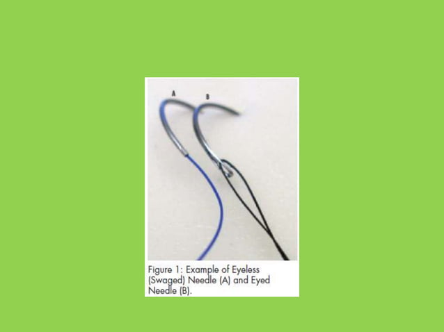 Principles of suture and flap design | PPTX