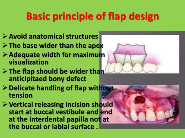 Principles of suture and flap design | PPTX